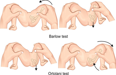 Newborn Examination Nipe Mla Medics