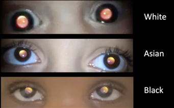 Newborn Examination (NIPE) – MLA Medics