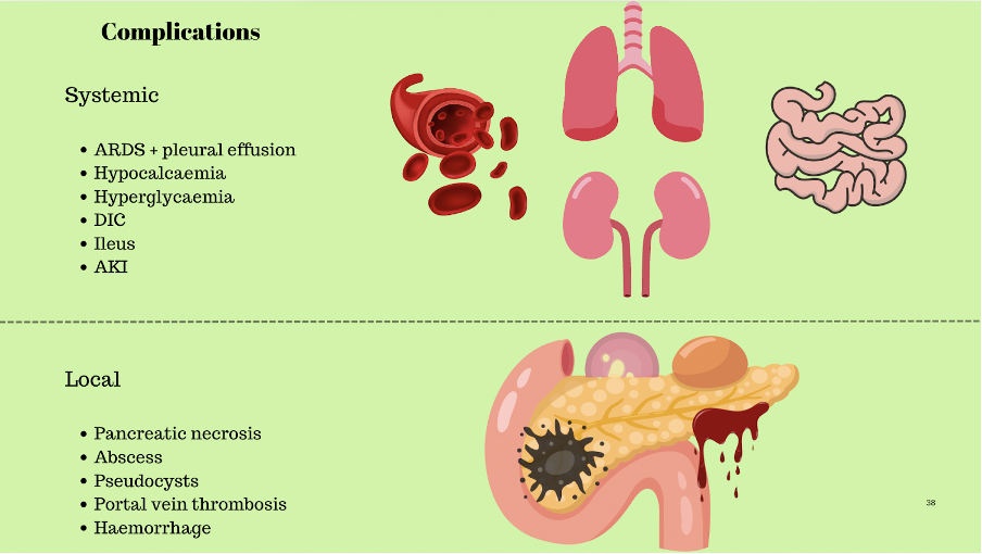 Acute Pancreatitis – MLA Medics