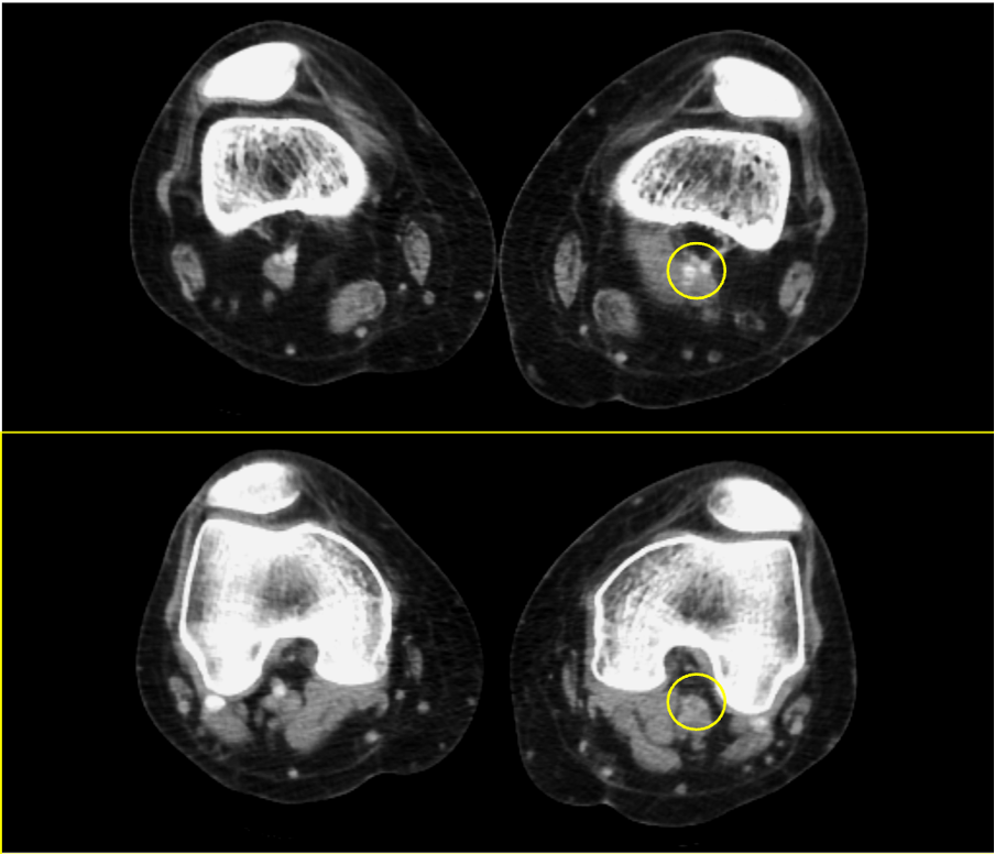 Cold, Painful, Pale, Pulseless Leg/Foot Station – MLA Medics